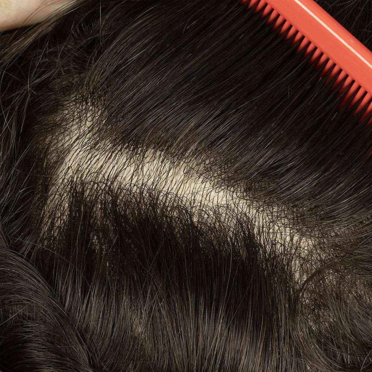 STSV | 0.06mm Ultra Thin Skin V-looped Men’s Hair System